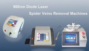 980nm Diode Laser Technology For Vascular Lesions Treatment | PrettyLasers