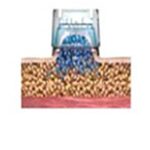 [Portable & Home Use] Best Cryolipolysis Machine | PrettyLasers