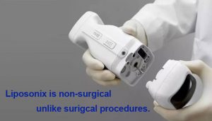 Liposonix Machine - Manufacturer & Supplier | PrettyLasers